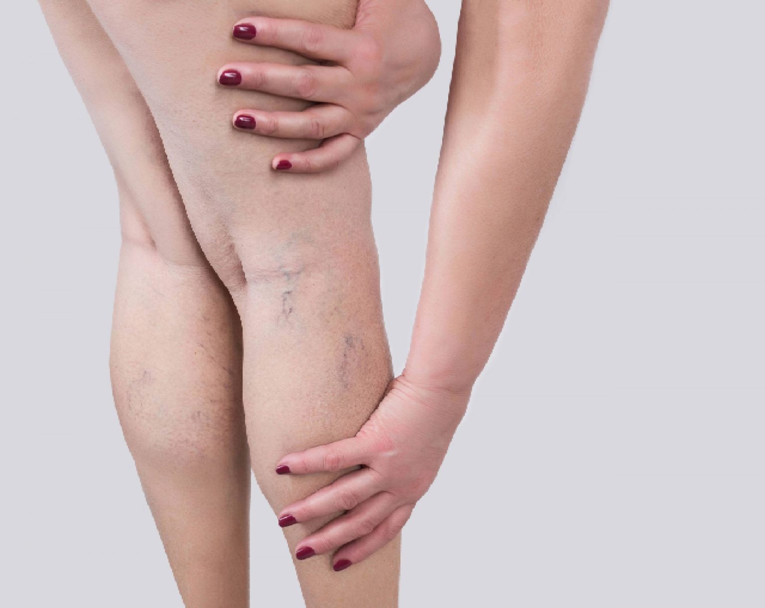 Trombosis venosa | Síntomas y tratamiento