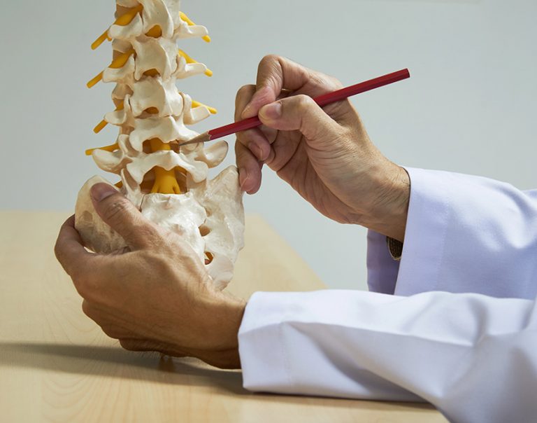 ¿Cuál es el tratamiento de la hernia discal?