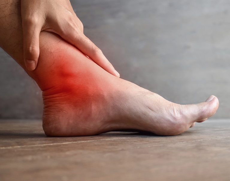 Niveles altos de ácido úrico: Causas, síntomas y cómo controlarlo