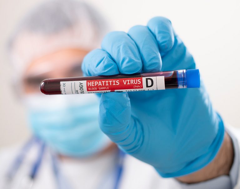 Hepatitis D: ¿Cómo se puede prevenir?