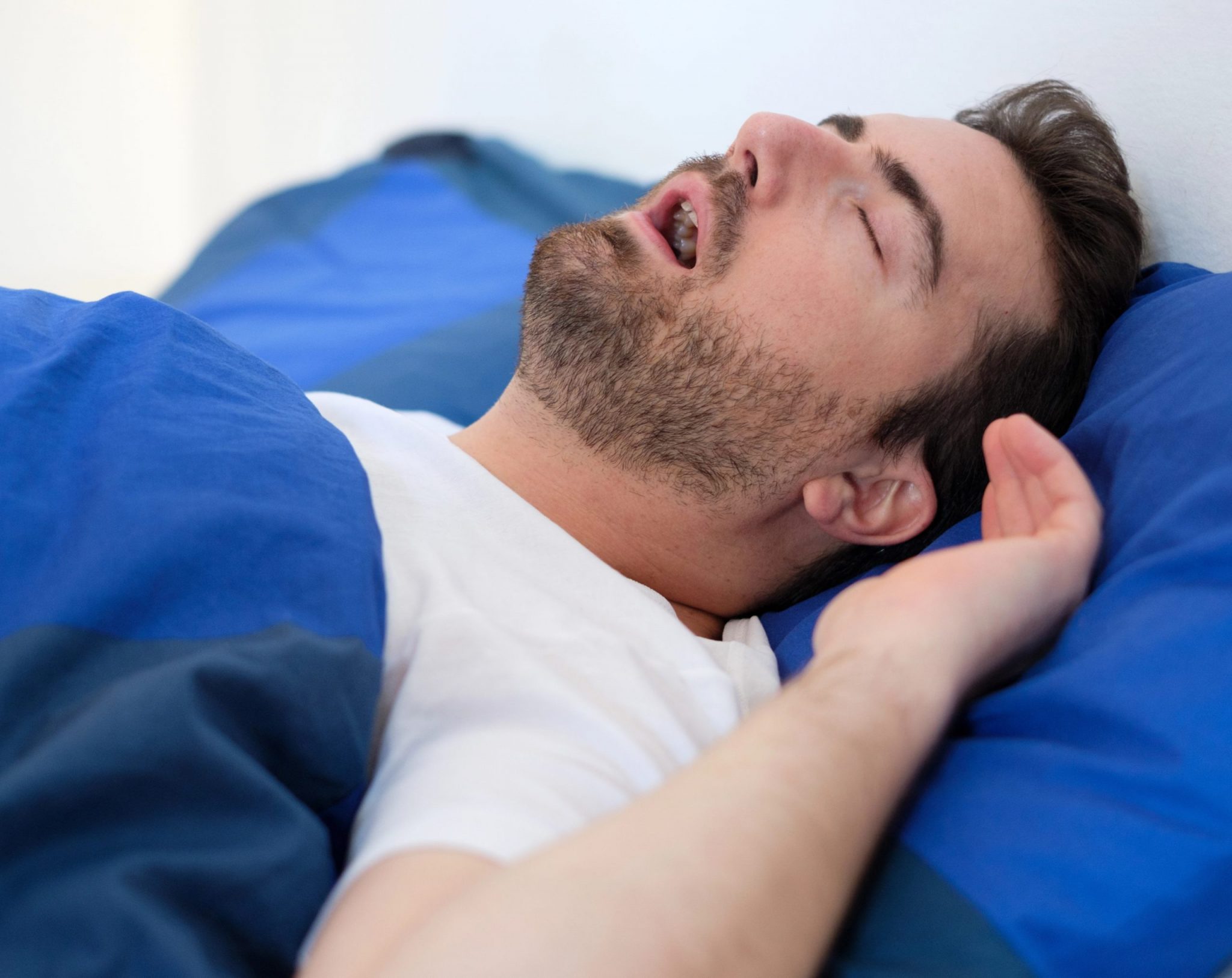 Apnea del sueño | Tipos, síntomas y tratamiento