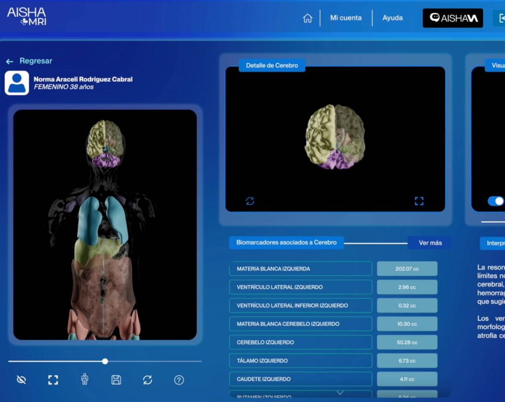AISHA MRI: La resonancia magnética del futuro
